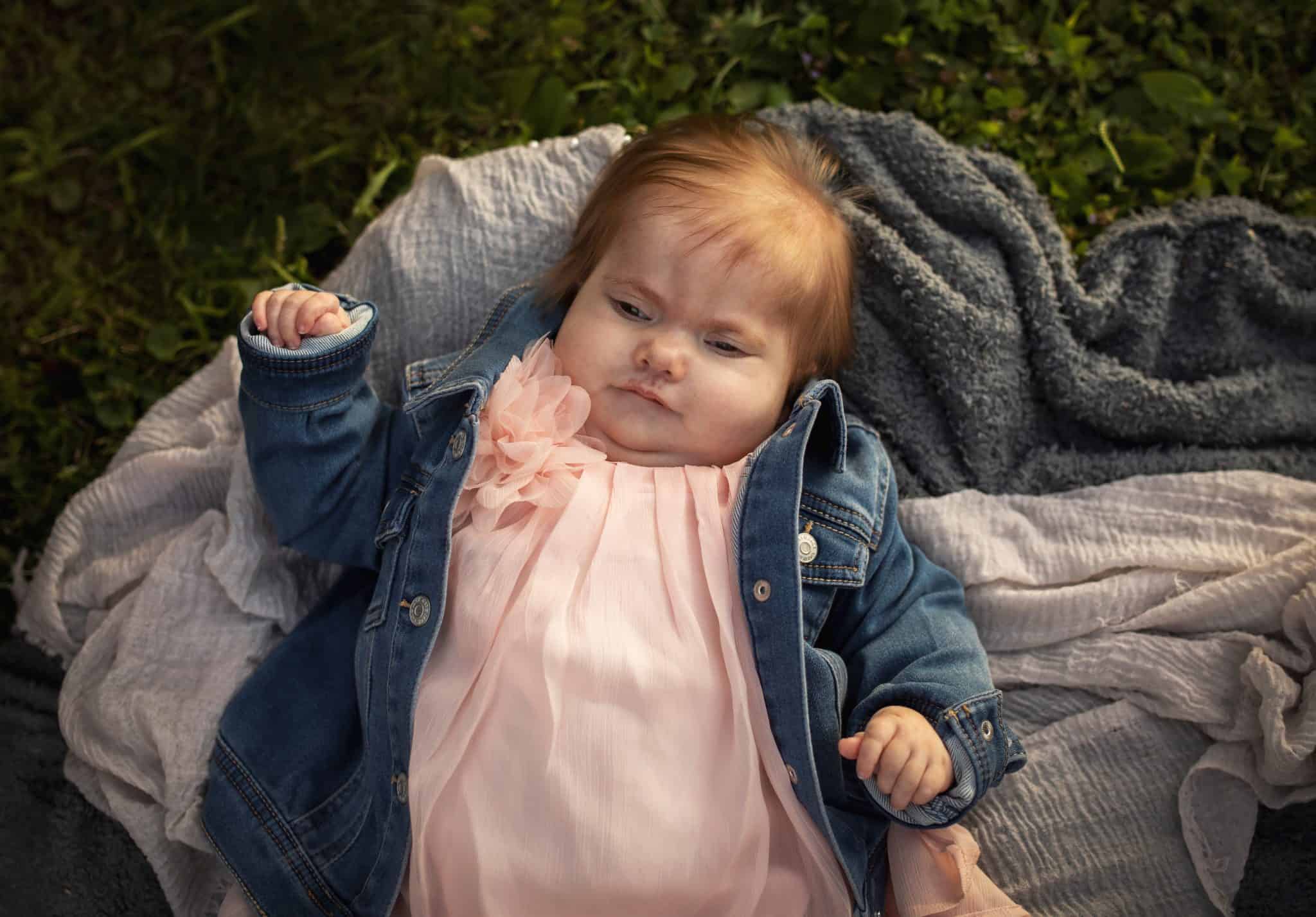 Ava's Story - Schinzel-Giedion Syndrome Foundation