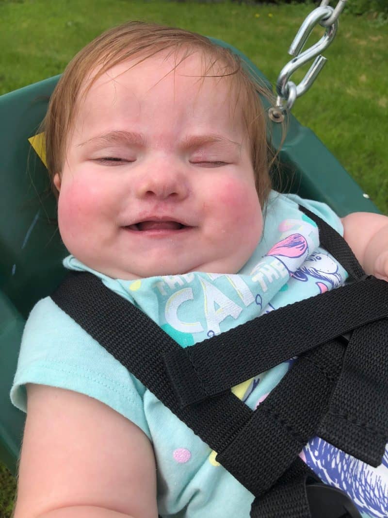 Ava's Story - Schinzel-Giedion Syndrome Foundation